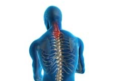 Neck Strains Murfreesboro | Neck Sprains Nashville | Neck Pain ...